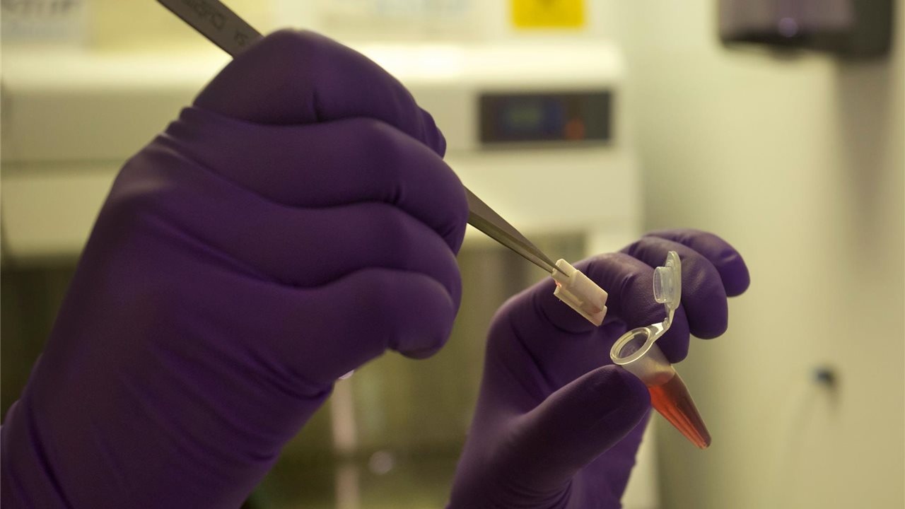 Reportajes y fotografías de Sida en National Geographic