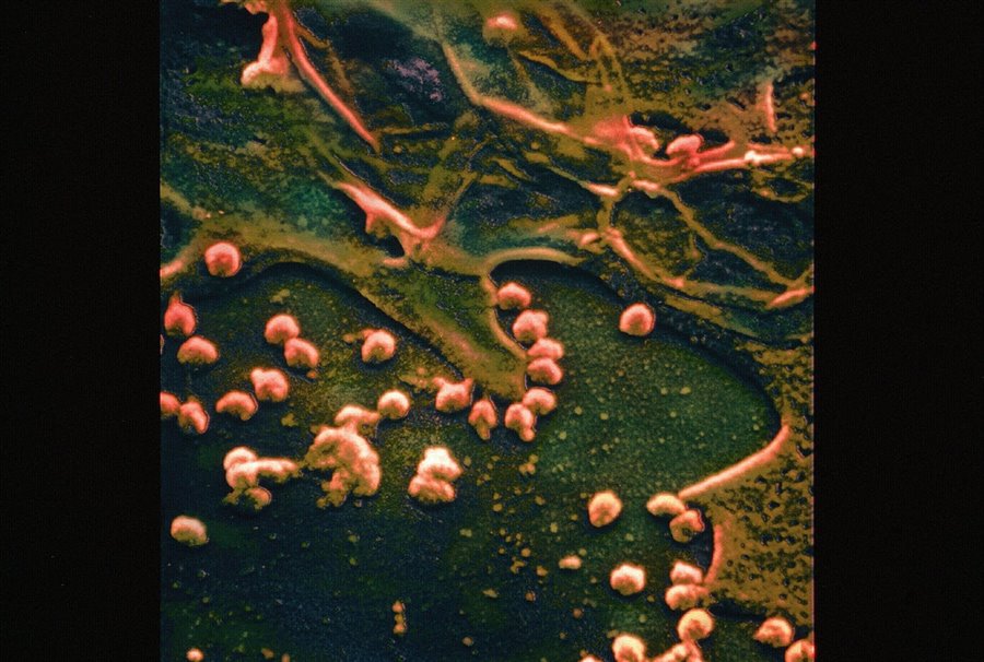 Así se ven el virus Nipah, el VIH y otros bajo el microscopio