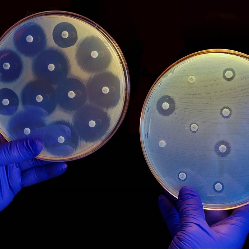 Las Superbacterias Podrían Haber Acabado Con La Vida De 50 Millones De
