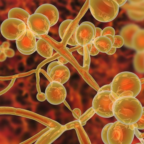 ¿Qué es la Candida parapsilosis y cómo se trata?