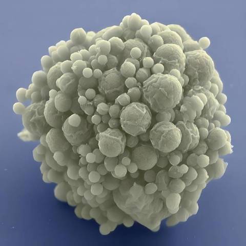 Lokiarchaeota, la hipótesis del hidrógeno y el surgimiento de la célula ...