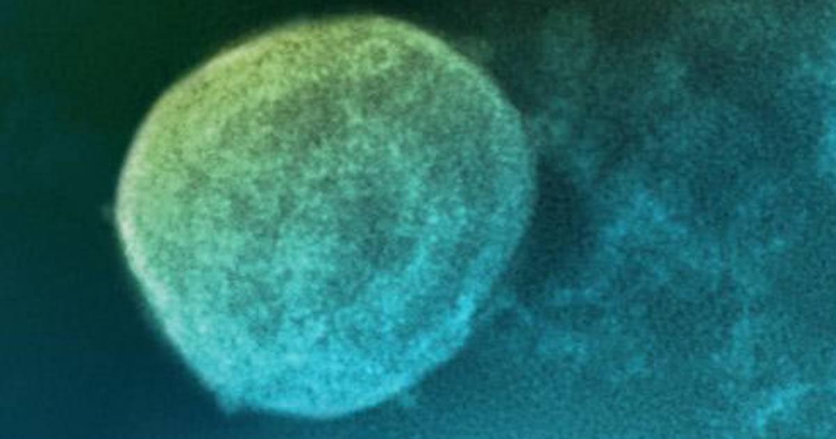 Así se ven el virus Nipah, el VIH y otros bajo el microscopio