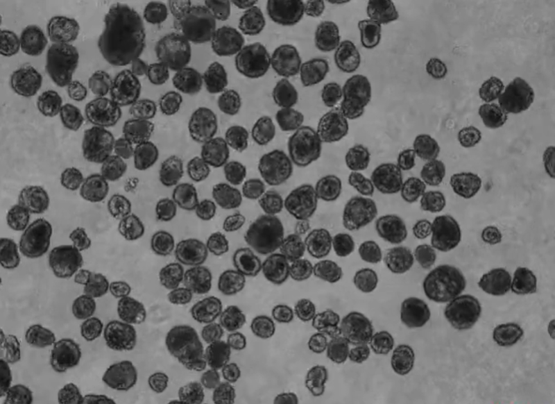 Anthrobots, la promesa de la robótica para reparar tejidos y órganos