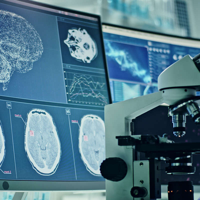 Cómo el mapa cerebral de la mosca de la fruta puede revolucionar la ...