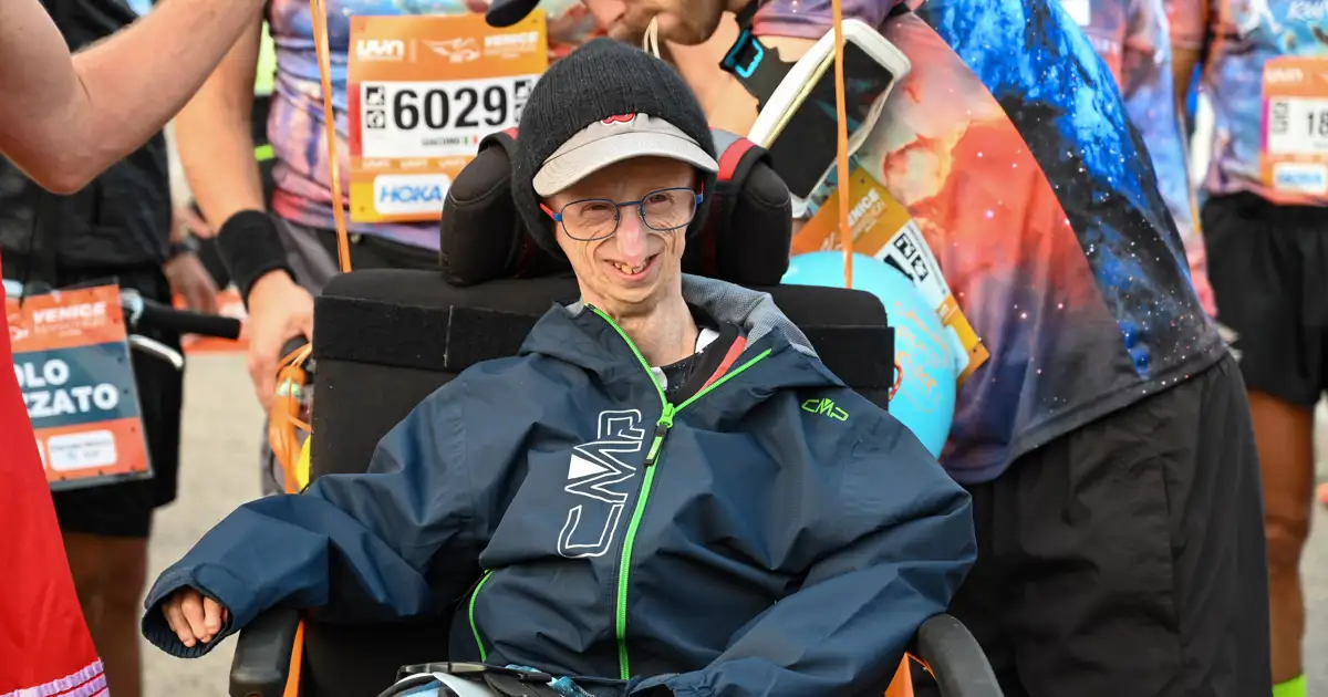 Qué es la progeria, la extraña enfermedad que padecía Sammy Basso