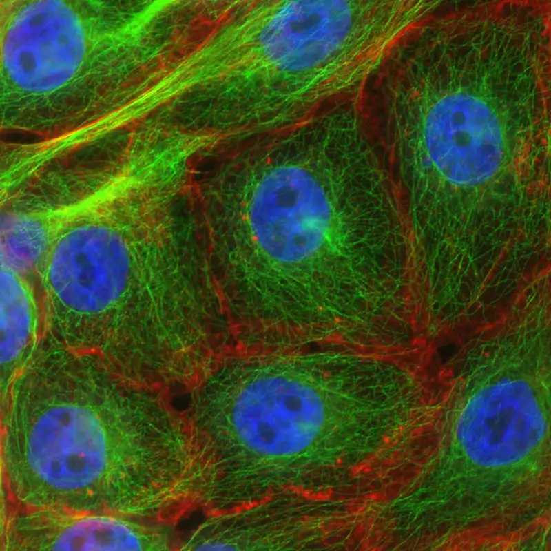 La Primera Vacuna Contra El Cáncer De Pulmón Se Pone A Prueba En Europa