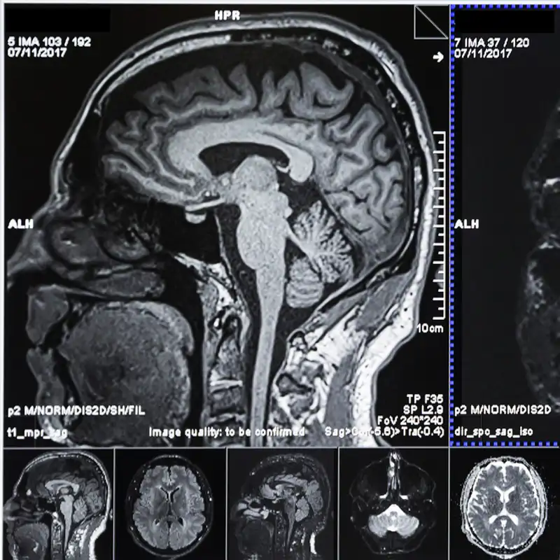 Darla Zelenitsky, paleontóloga: “Es increíblemente raro. Eran garras ...