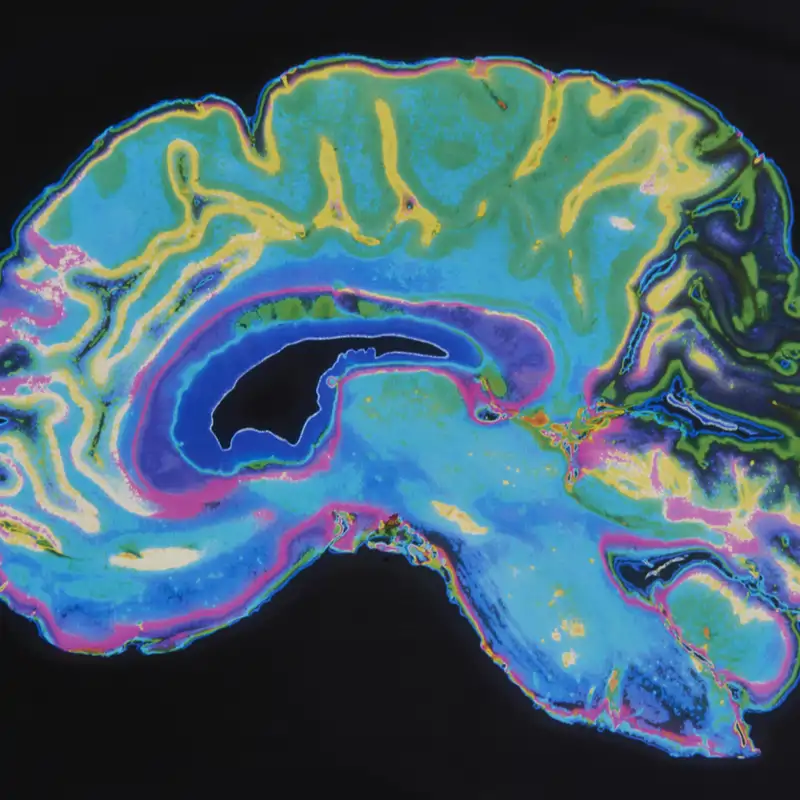 Estudian el cerebro y descubren qué pasa cuando masticas chicle